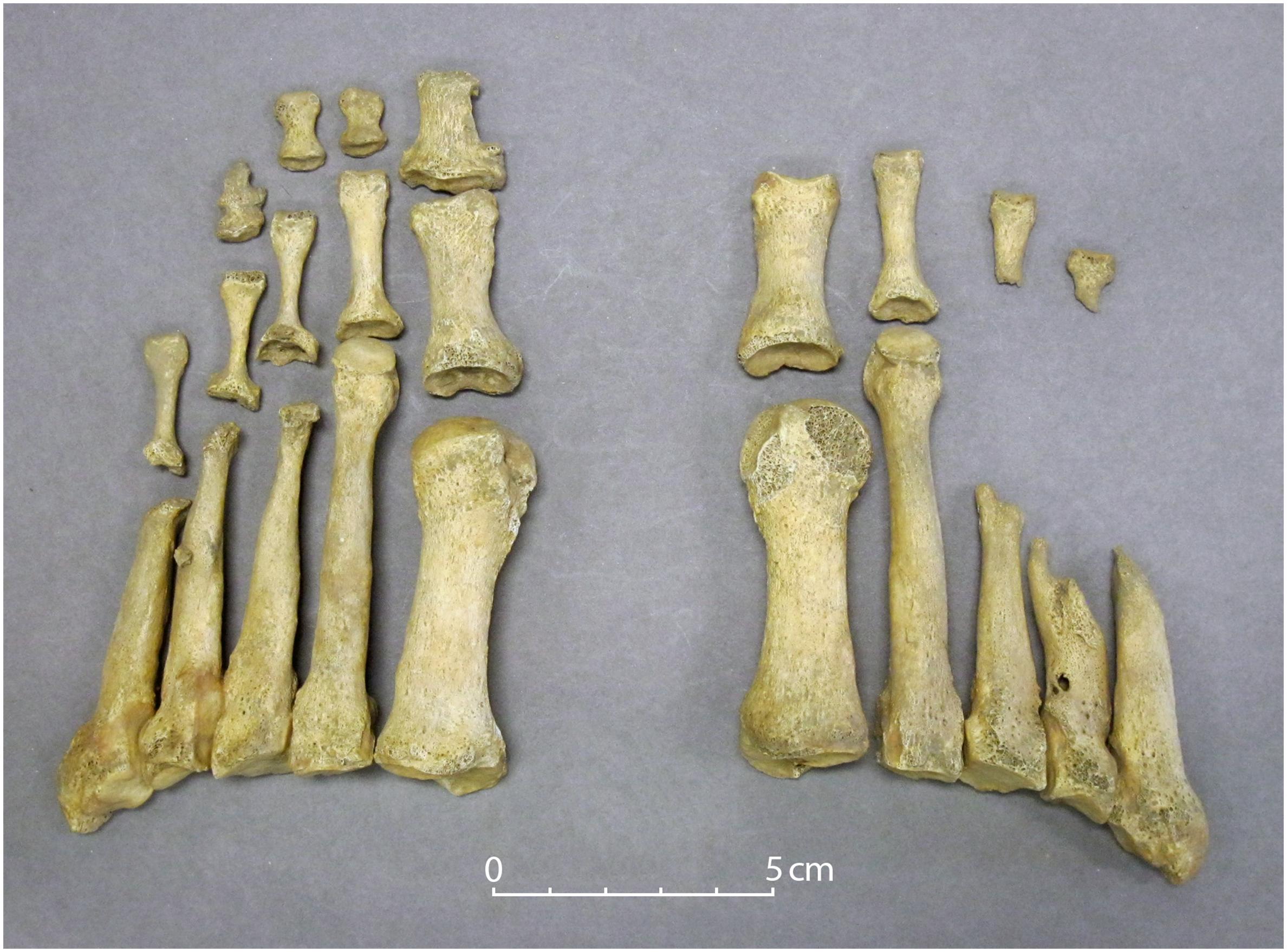 New Research Suggests That The Vikings Brought Leprosy To Ireland ...