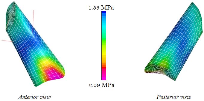 Finite Element Modelling Of Biological Connective Soft Tissue