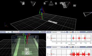 Assessing performance of knee athroplasty using clinical testing ...