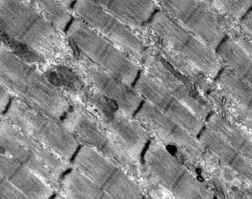 TEM Image Gallery | Biomedical Imaging Unit | University of Southampton