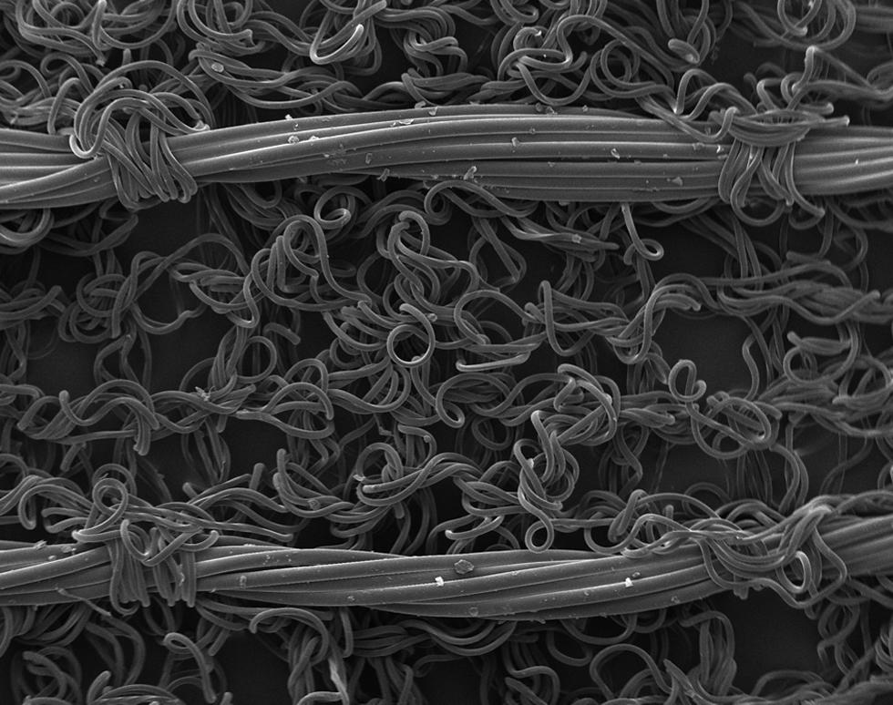 SEM Image Gallery | Biomedical Imaging Unit | University of Southampton