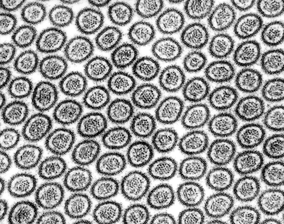 TEM Image Gallery | Biomedical Imaging Unit | University of Southampton