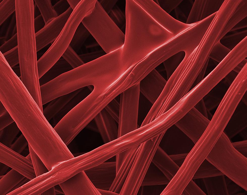 SEM Image Gallery | Biomedical Imaging Unit | University of Southampton