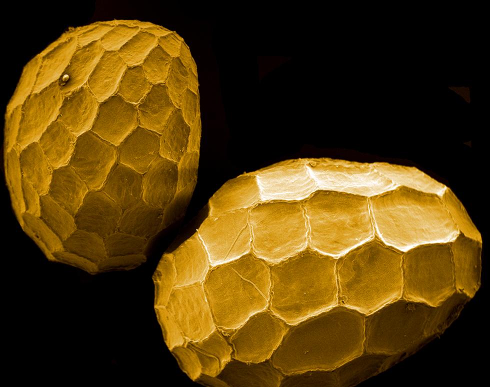 SEM Image Gallery | Biomedical Imaging Unit | University of Southampton