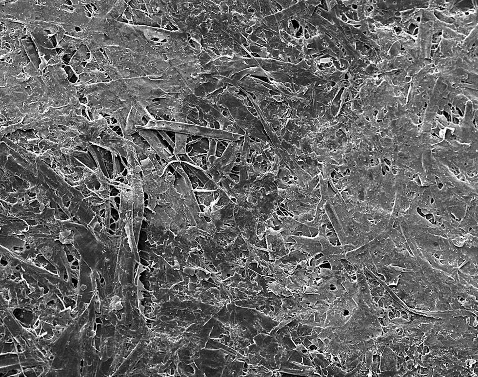 SEM Image Gallery | Biomedical Imaging Unit | University of Southampton