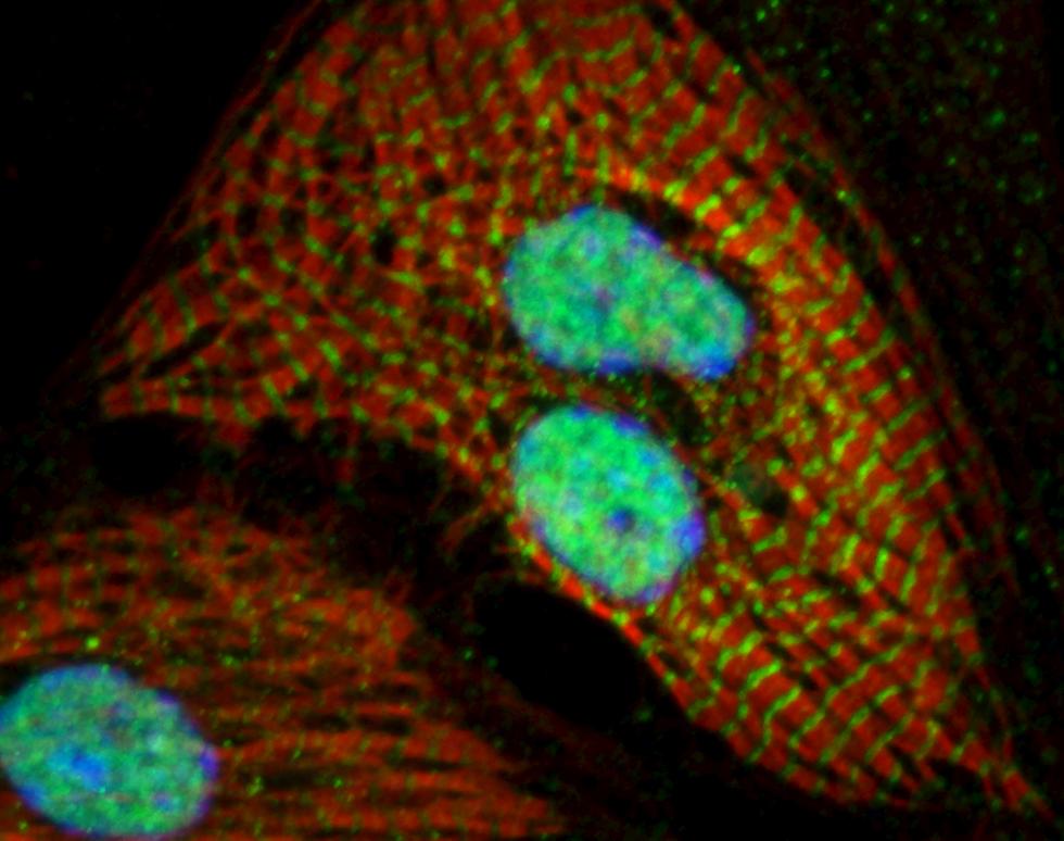 Confocal Image Gallery | Biomedical Imaging Unit | University of ...