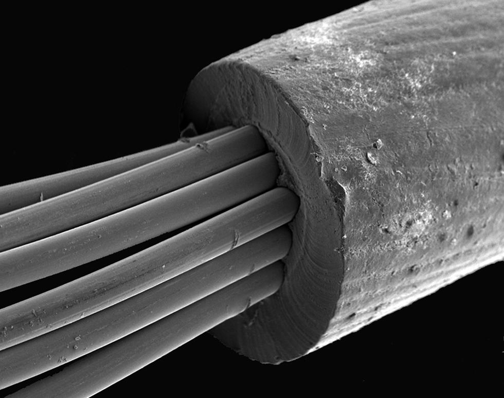 SEM Image Gallery | Biomedical Imaging Unit | University of Southampton