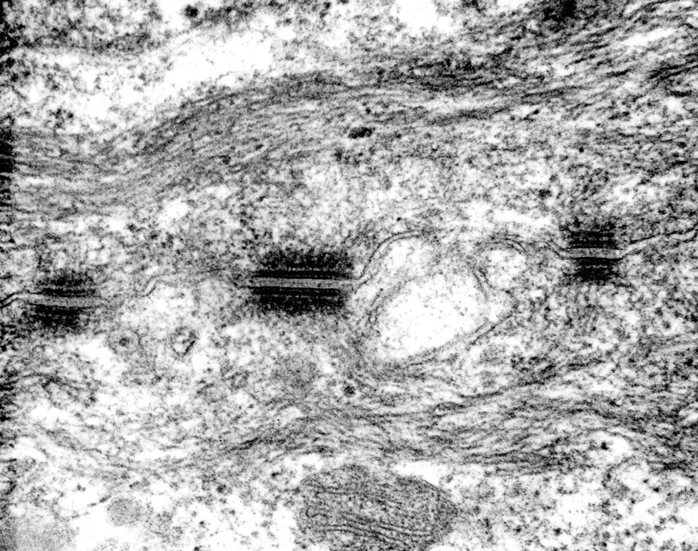 TEM Image Gallery | Biomedical Imaging Unit | University of Southampton