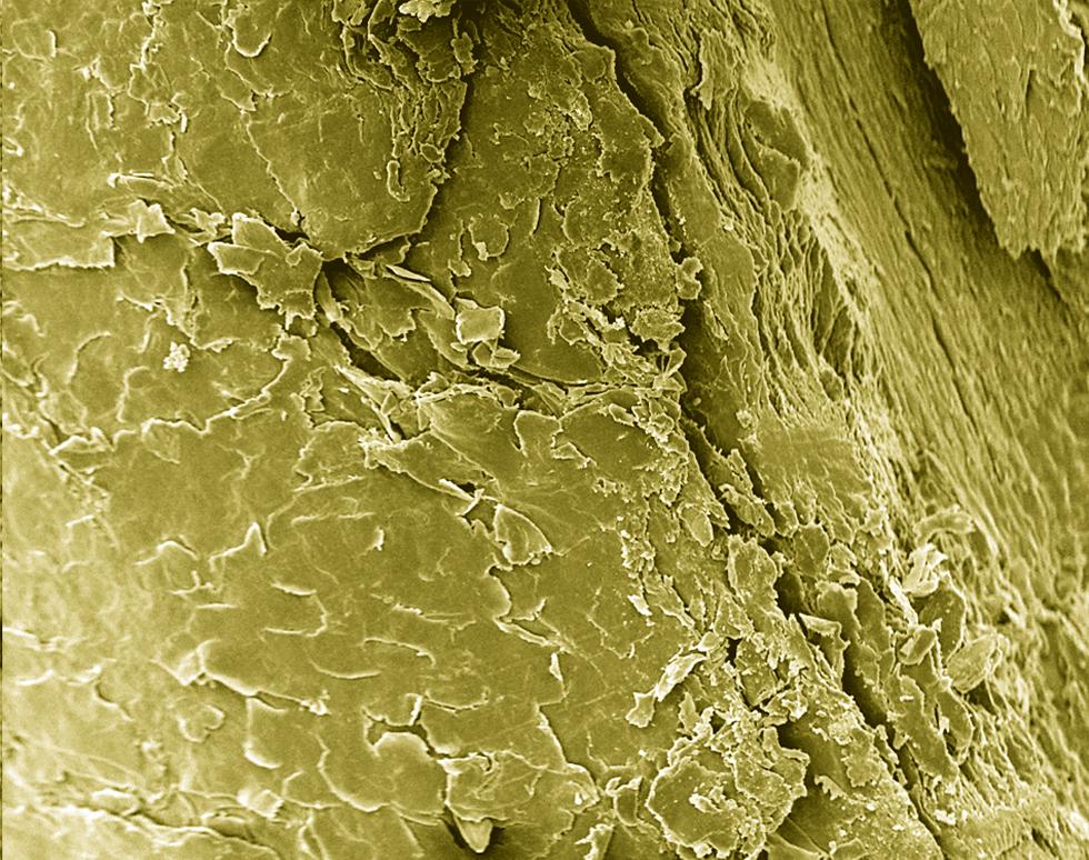 SEM Image Gallery | Biomedical Imaging Unit | University of Southampton