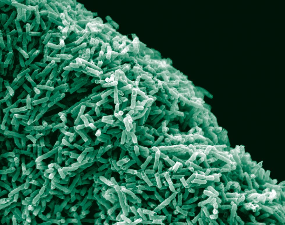 SEM Image Gallery | Biomedical Imaging Unit | University of Southampton