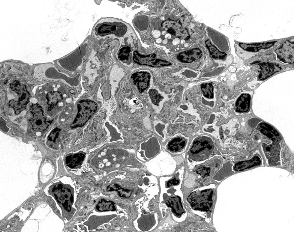 TEM Image Gallery | Biomedical Imaging Unit | University of Southampton