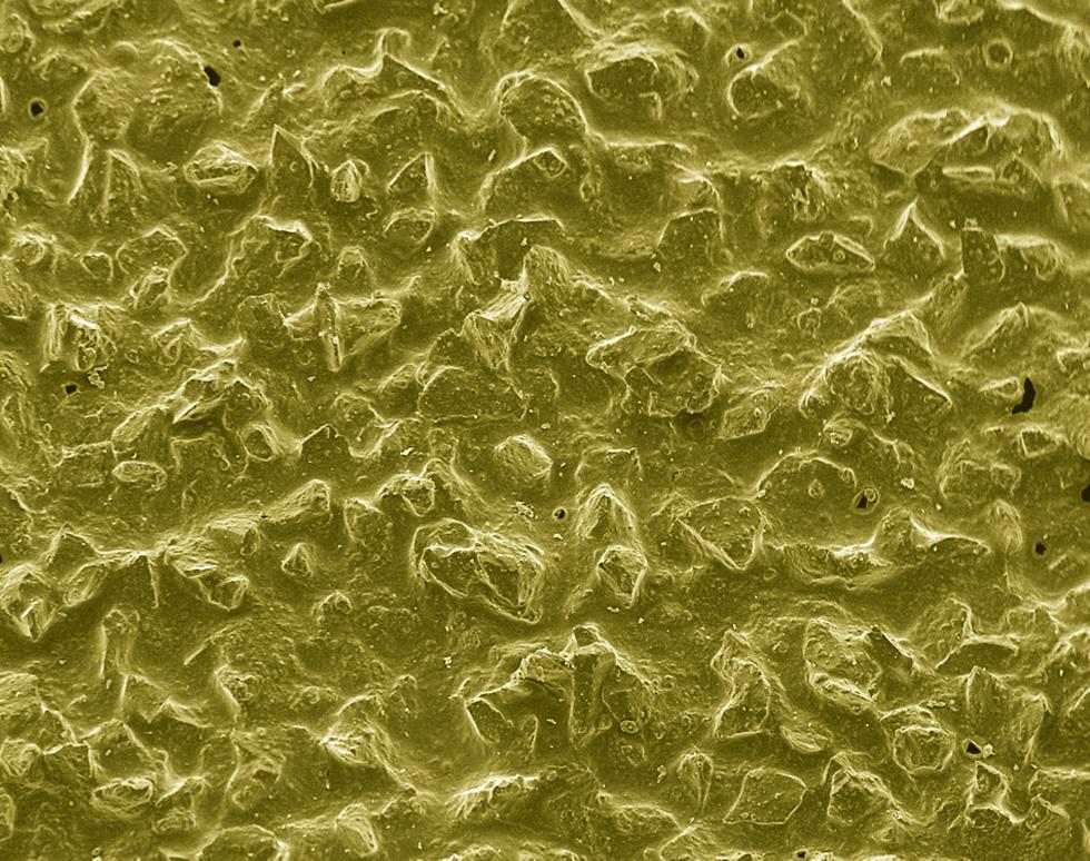 SEM Image Gallery | Biomedical Imaging Unit | University of Southampton