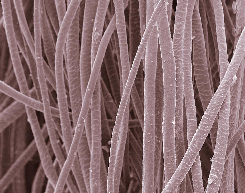 SEM Image Gallery | Biomedical Imaging Unit | University of Southampton