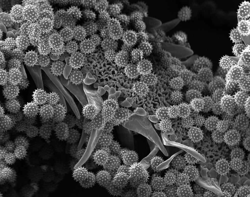 SEM Image Gallery | Biomedical Imaging Unit | University of Southampton