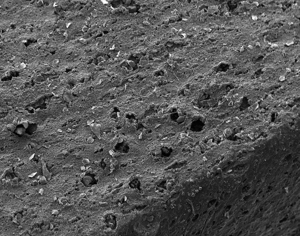 SEM Image Gallery | Biomedical Imaging Unit | University of Southampton