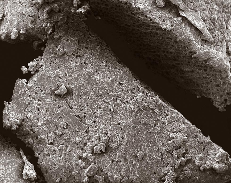 SEM Image Gallery | Biomedical Imaging Unit | University of Southampton