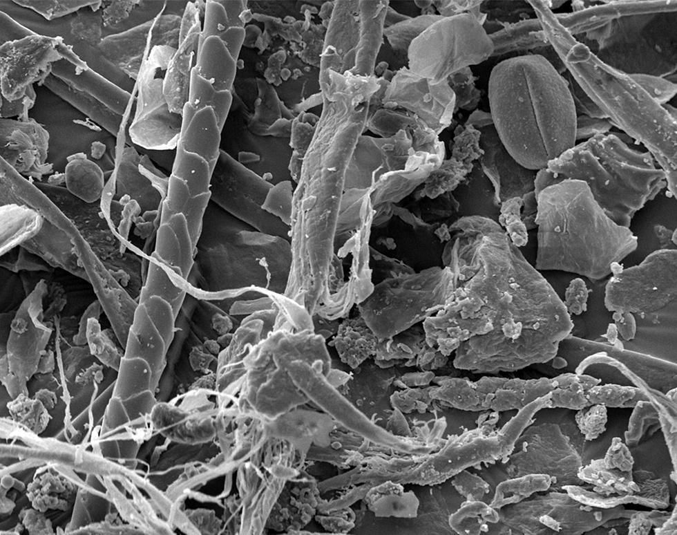 SEM Image Gallery | Biomedical Imaging Unit | University of Southampton